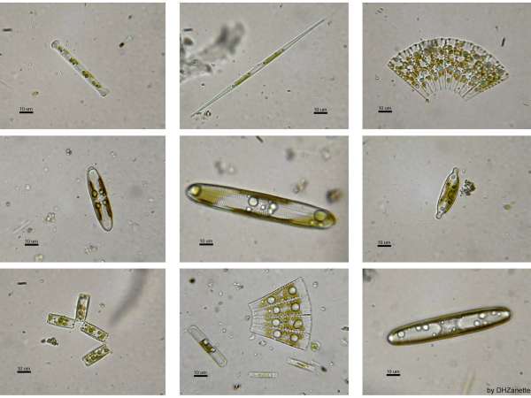 Kieselalgen im Aquarium - Bacillariophyta | WIKI